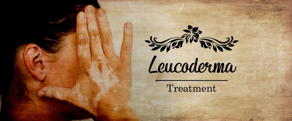 Ayurvedic Leucoderma Treatment in Pune | Dr. Manoj Deshpande