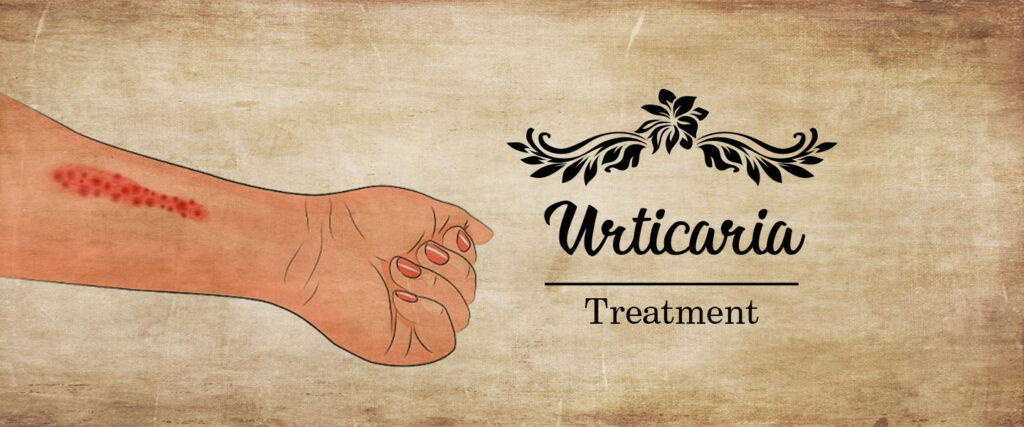 Ayurvedic Urticaria Treatment in Pune | Dr. Manoj M. Deshpande